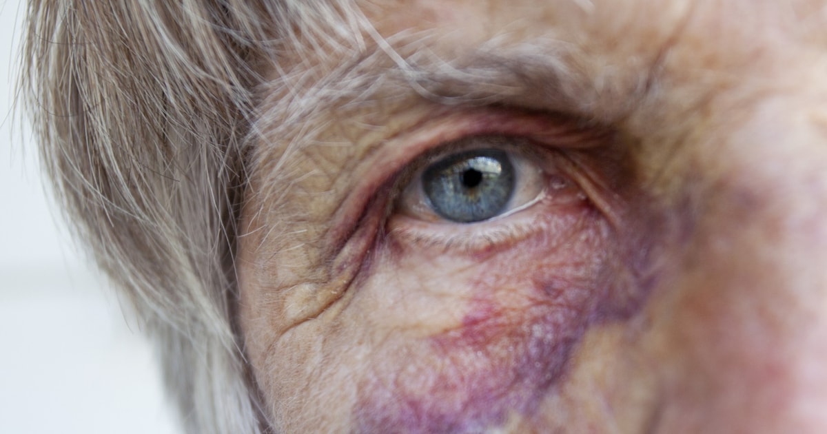 Roosendaler (57) slaat lens dwars door iris van zijn tante (91): ‘Ze is ...