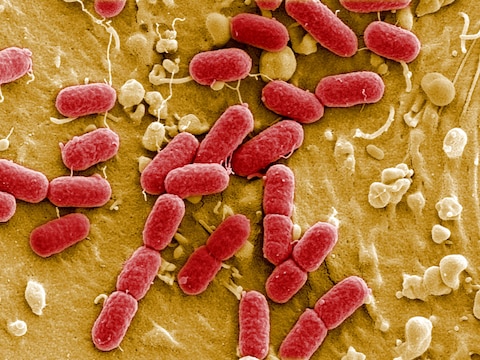 E. coli-bacterie in waterleiding IJpelaar Breda: ‘We zijn allemaal aan ...
