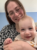 Elke week worden er vier kinderen geboren met een extra vinger en dan ...