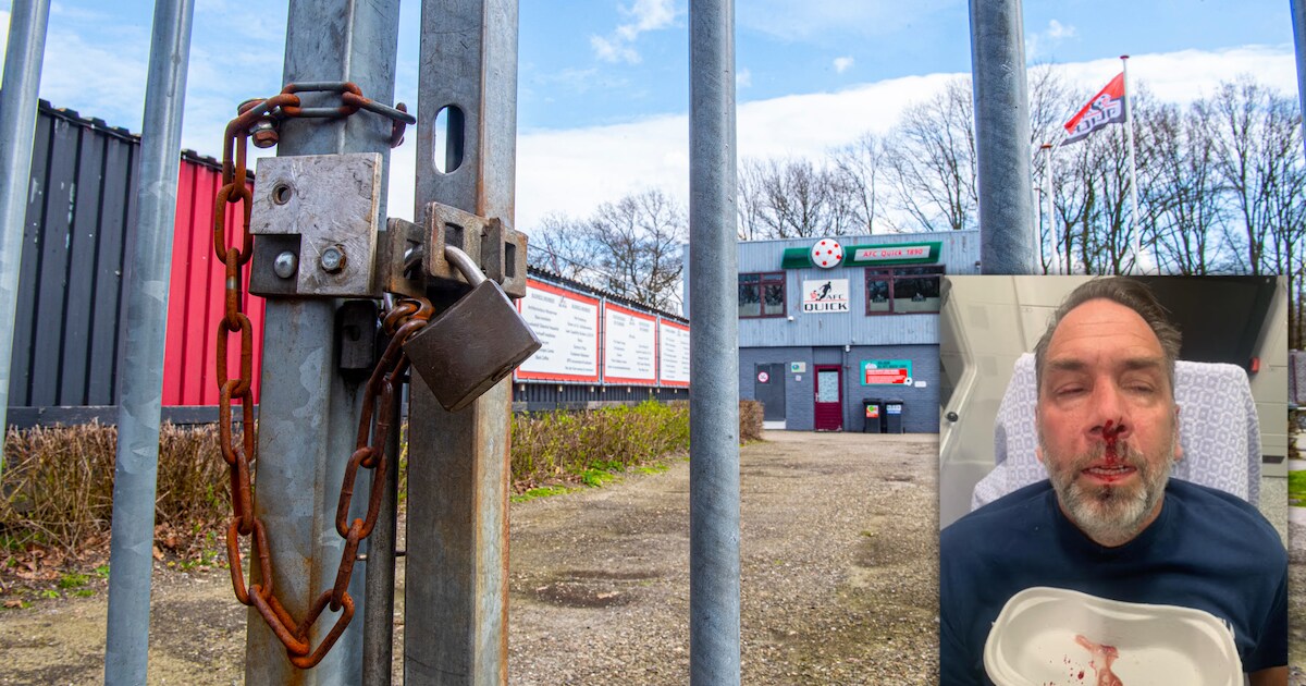 Gebroken neus, oogletsel en hersenschudding voor Eelco (49) na afloop ...