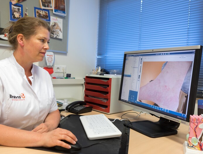 Dermatoloog vreest mensen met huidkanker te missen | Roosendaal ...