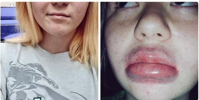 Artsen waarschuwen voor gevaarlijke deo-challenge: ‘Kinderen zijn zich ...